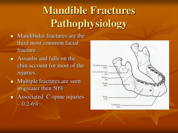 PPT - Maxillofacial trauma PowerPoint Presentation - ID:4518457