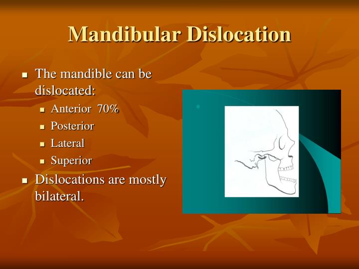PPT - Maxillofacial trauma PowerPoint Presentation - ID:4518457