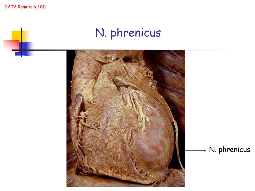 PPT - Omuz Bölgesine Yansıyan Radiküler ve Viseral Ağrılar PowerPoint ...