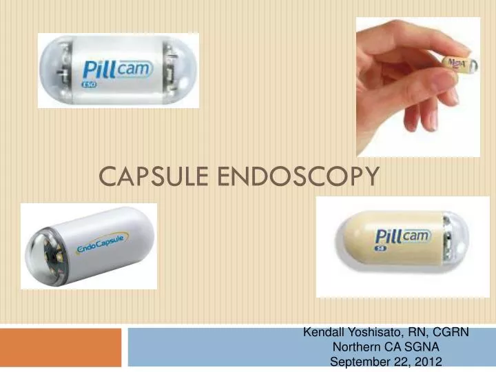 PPT - Capsule Endoscopy PowerPoint Presentation, free download - ID:4521276
