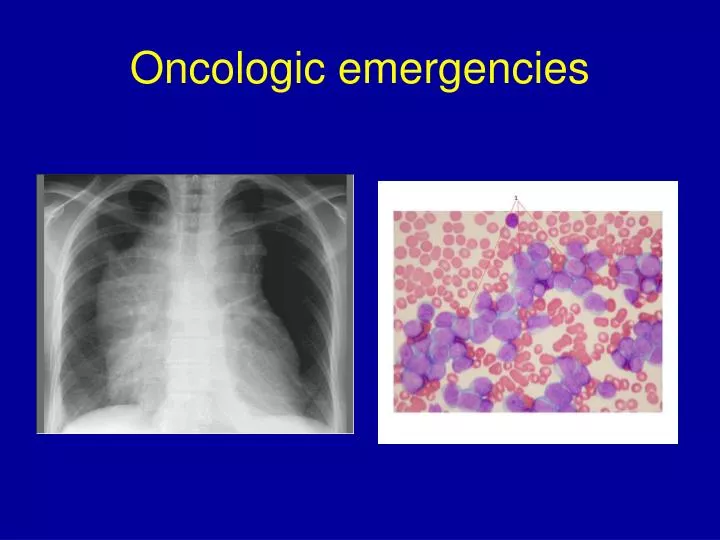 PPT - Oncologic emergencies PowerPoint Presentation, free download - ID ...
