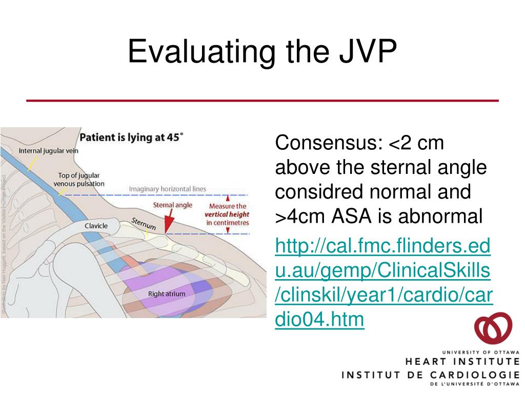 PPT - Cardiology Review: Heart Failure and Valve Disease March 30, 2009 ...