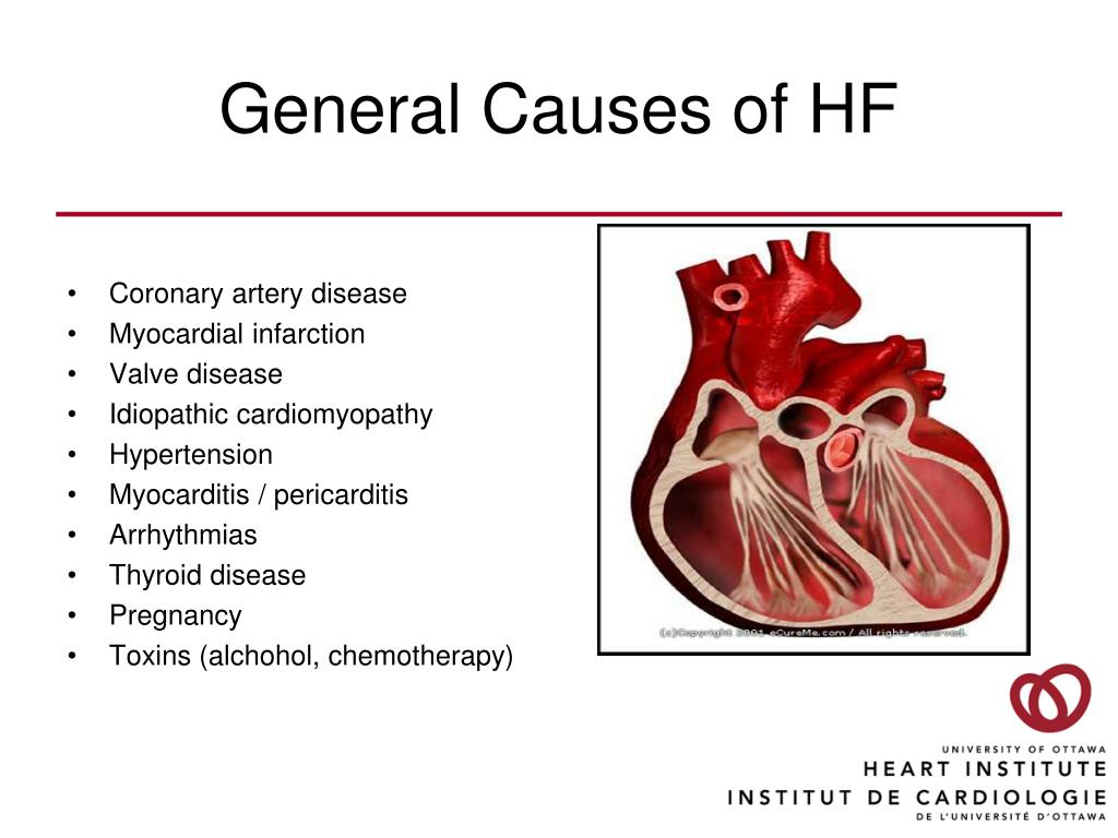 PPT - Cardiology Review: Heart Failure and Valve Disease March 30, 2009 ...