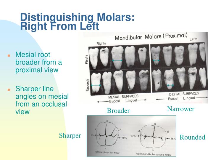 PPT - Molars PowerPoint Presentation - ID:4524183