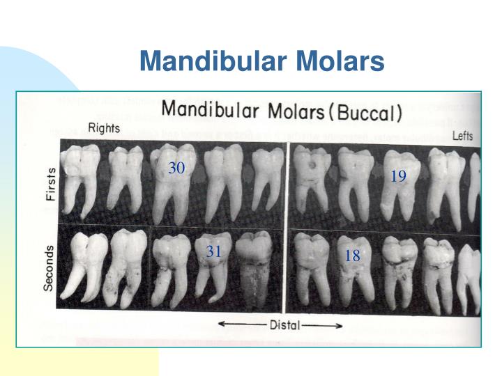PPT - Molars PowerPoint Presentation - ID:4524183