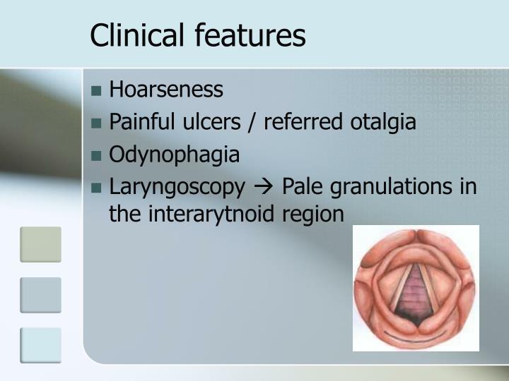 PPT - Chronic laryngitis PowerPoint Presentation - ID:4527929