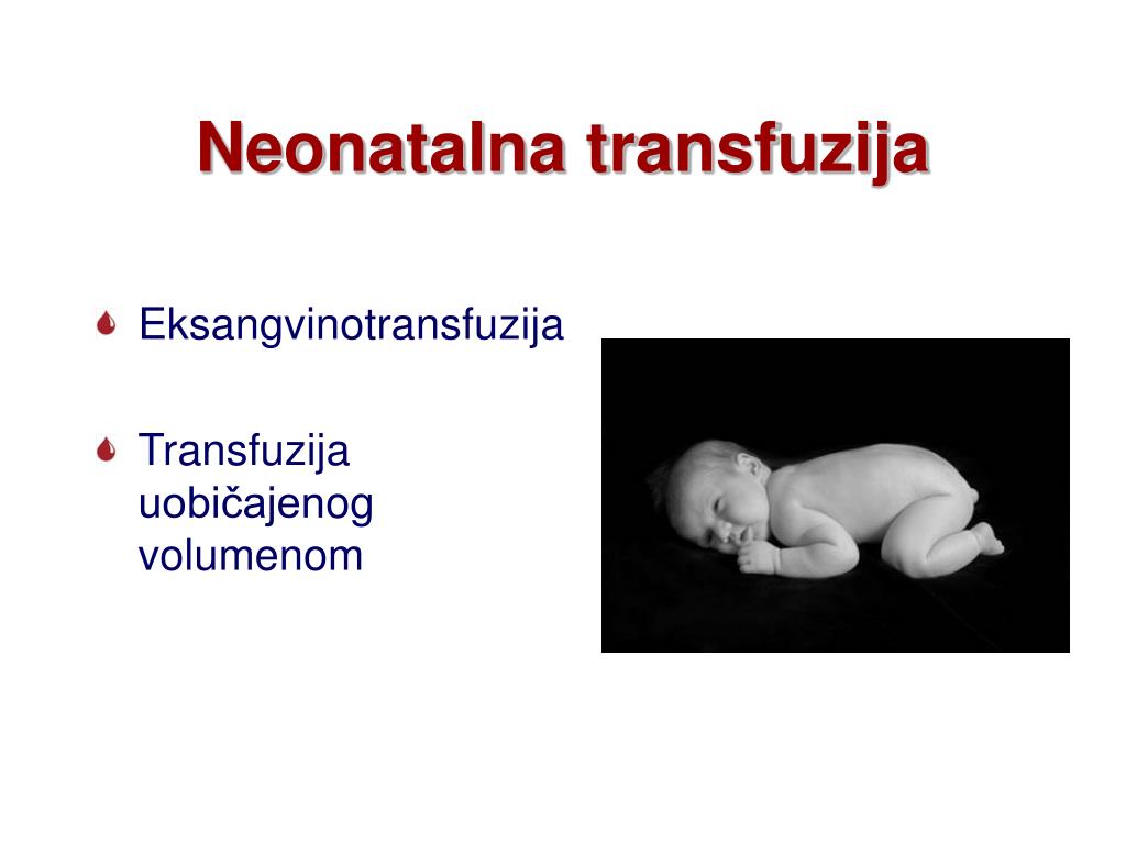 PPT - DECA SA SPECIFIČNIM POTREBAMA ZA TRANSFUZIJOM PowerPoint ...