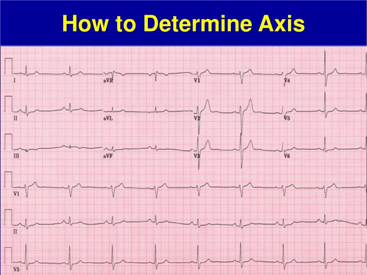 PPT - ECG Lecture Part 1 ECG Interpretation Selim Krim, MD Assistant ...