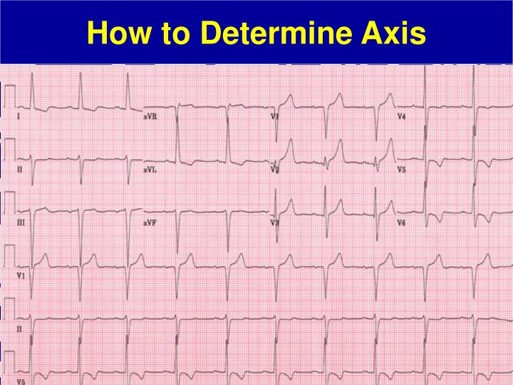 PPT - ECG Lecture Part 1 ECG Interpretation Selim Krim, MD Assistant ...