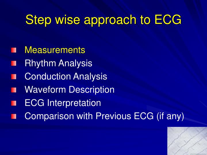PPT - ECG Lecture Part 1 ECG Interpretation Selim Krim, MD Assistant ...