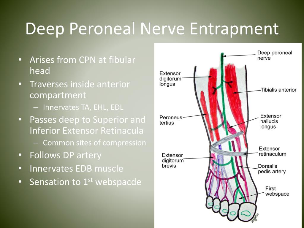 PPT Nerve Entrapments In Runners PowerPoint Presentation Free