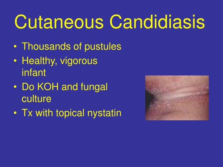 PPT - Common Rashes in the Newborn PowerPoint Presentation - ID:4540089