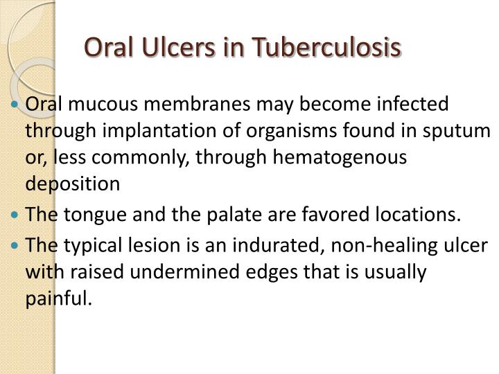 PPT - Oral Ulcers PowerPoint Presentation - ID:4541435