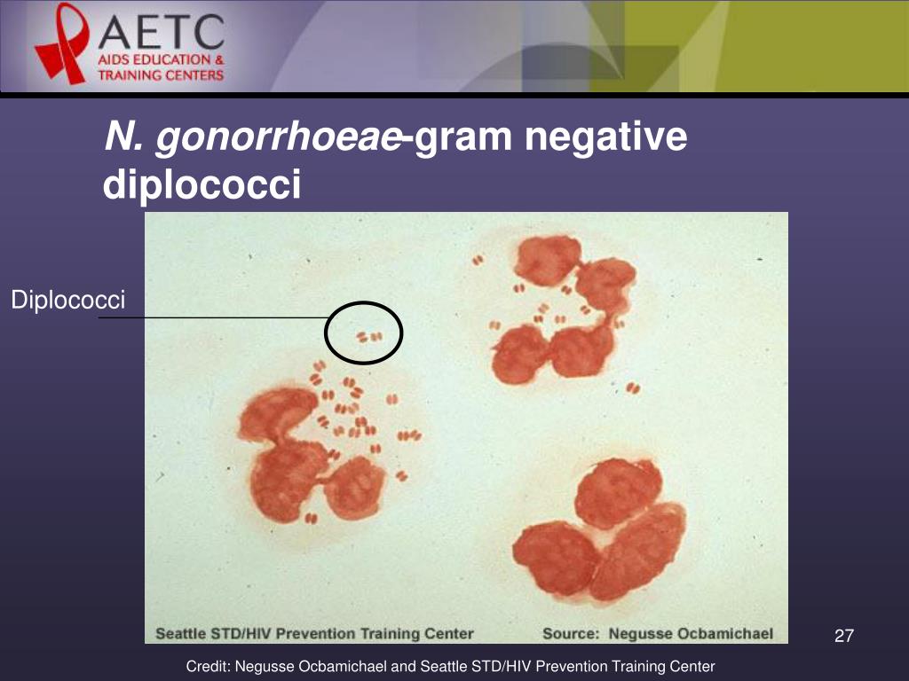 PPT - Common Sexually Transmitted Diseases (STDs) and HIV-Infected ...