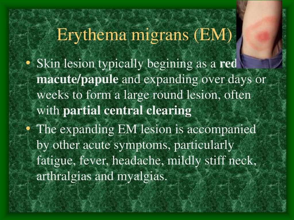 PPT - Lyme disease Lyme borreliosis PowerPoint Presentation, free ...