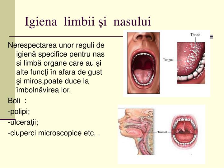 PPT - Organele de sim ţ PowerPoint Presentation - ID:4546404