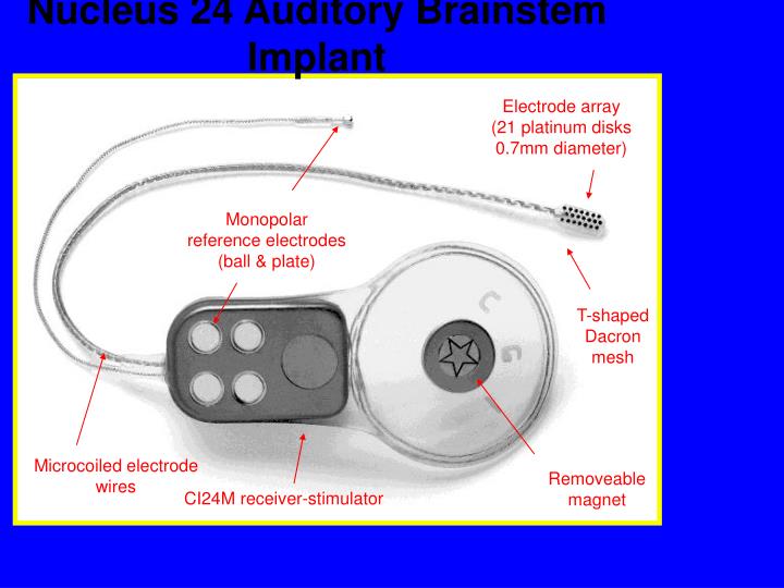 PPT - Auditory Brainstem Implant PowerPoint Presentation - ID:4558236