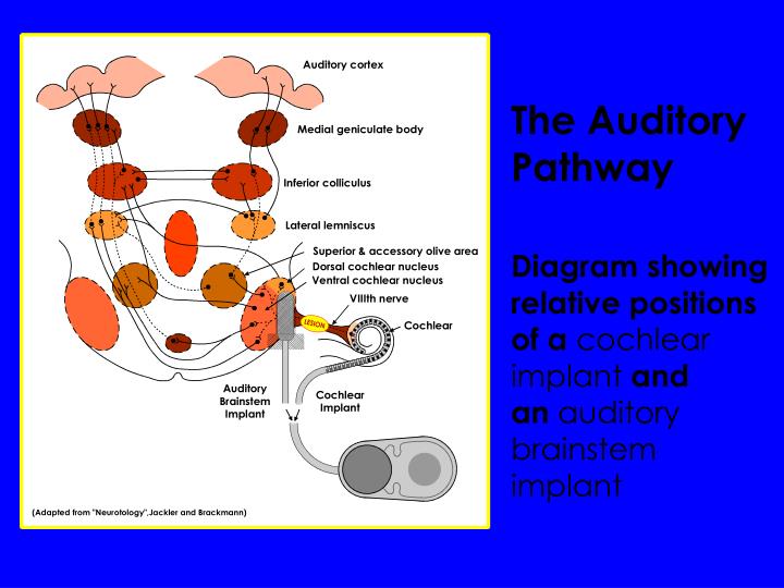 PPT - Auditory Brainstem Implant PowerPoint Presentation - ID:4558236