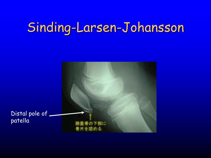 PPT - Pediatric Sports and Recreation Injuries PowerPoint Presentation ...