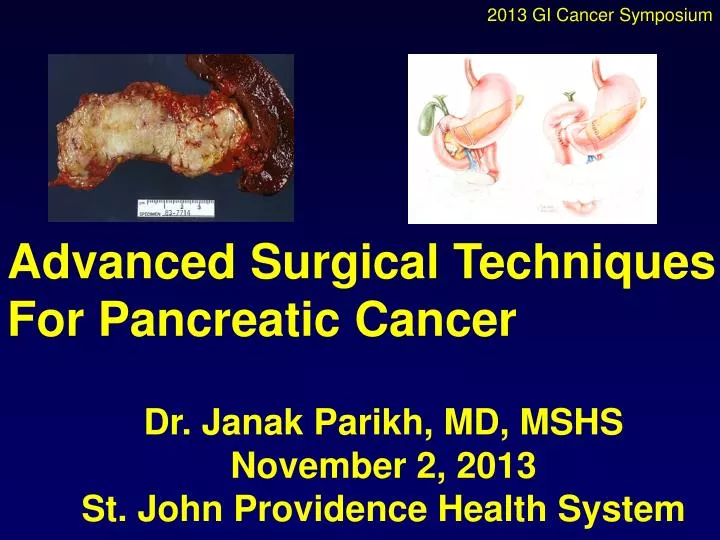 PPT - Advanced Surgical Techniques For Pancreatic Cancer PowerPoint ...