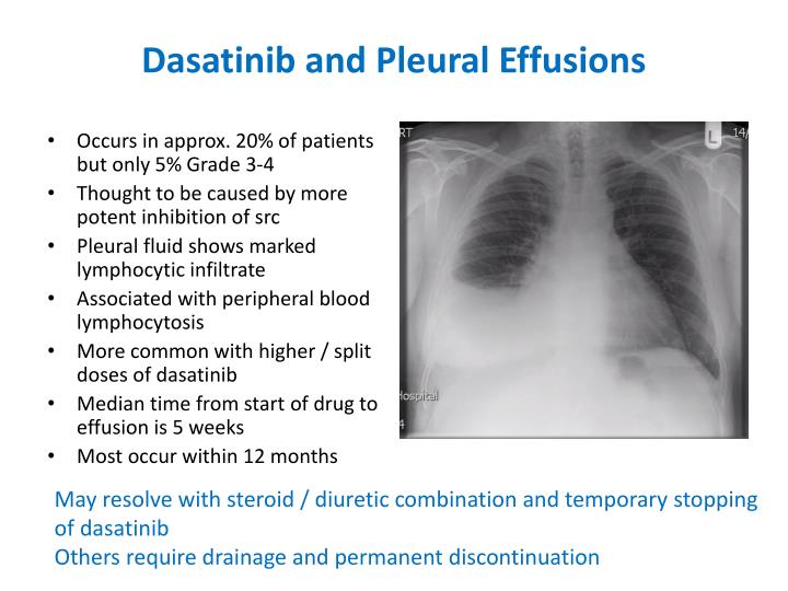 PPT - Update on the Side Effects of Tyrosine Kinase Inhibitors ...