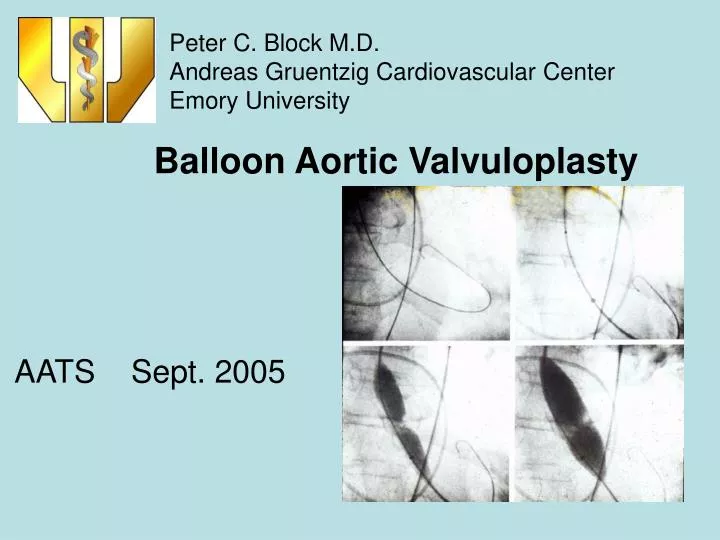PPT - Balloon Aortic Valvuloplasty PowerPoint Presentation, free ...