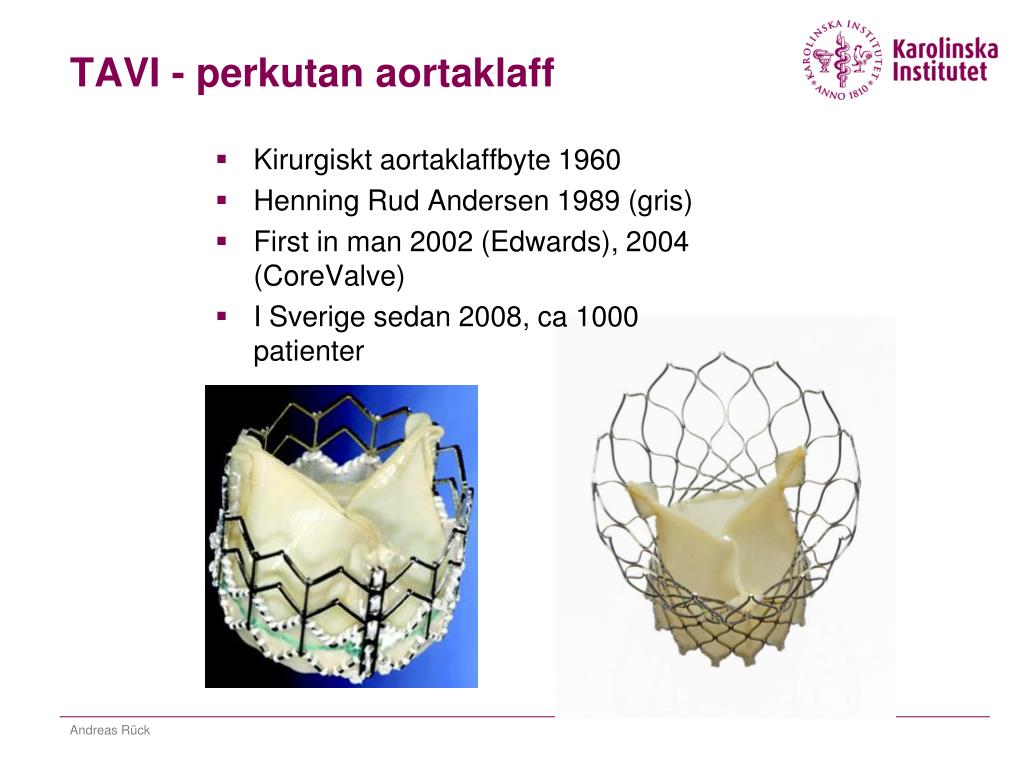 PPT - Transcatheter Aortic Valve Implantation (TAVI) 400 TAVI på Karolinska PowerPoint ...