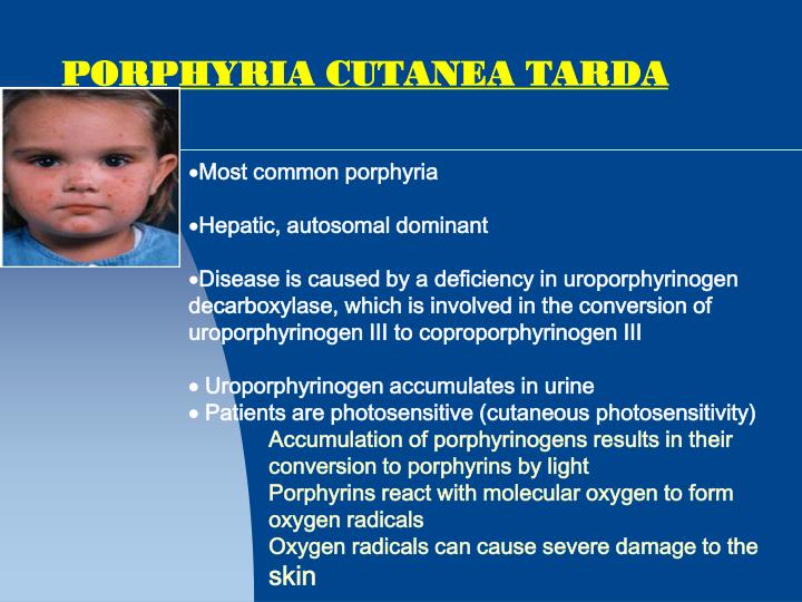 PPT - Disorders of Heme synthesis PowerPoint Presentation - ID:4565409