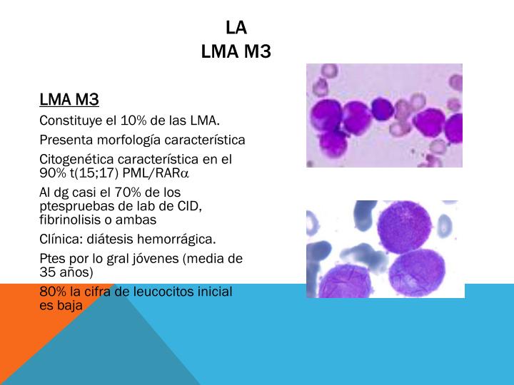 PPT - LEUCEMIAS AGUDAS (LA) PowerPoint Presentation - ID:4565837