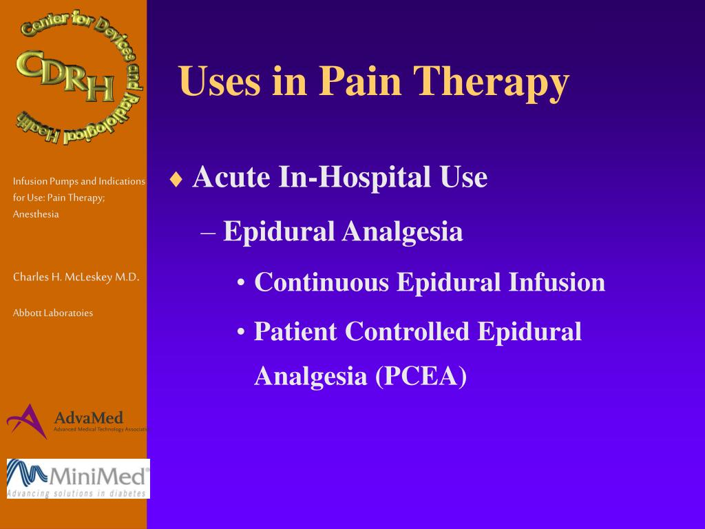PPT - Infusion Pumps and Indications for Use: Pain Therapy; Anesthesia ...