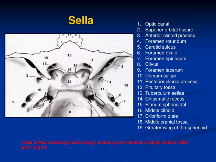 PPT - Sella turcica and parasellar region PowerPoint Presentation - ID ...