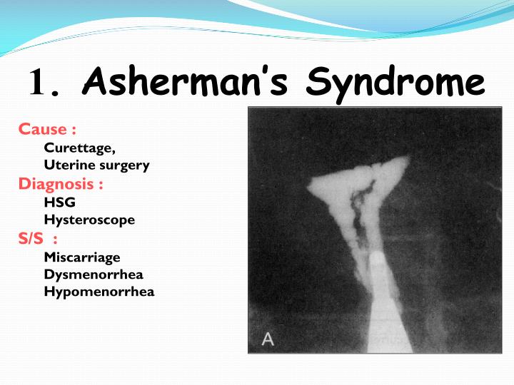 PPT - Disorders of menstrual function. Neuroendocrine syndromes in ...