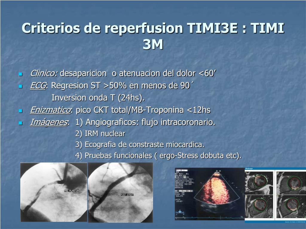 PPT - Dra. Lorena Villalba G. MD . Cardiología intervencionista. 2010 ...