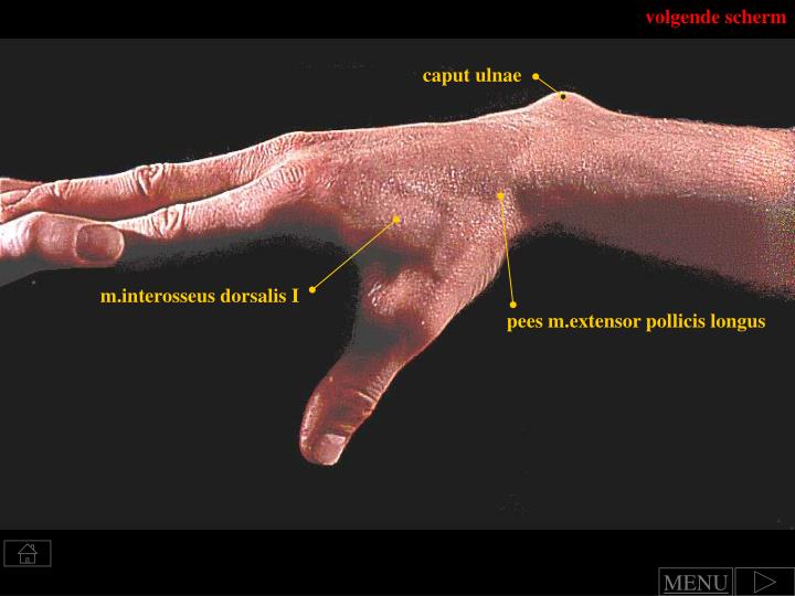 PPT - ANATOMIE in VIVO “het bewegingsapparaat” PowerPoint Presentation ...