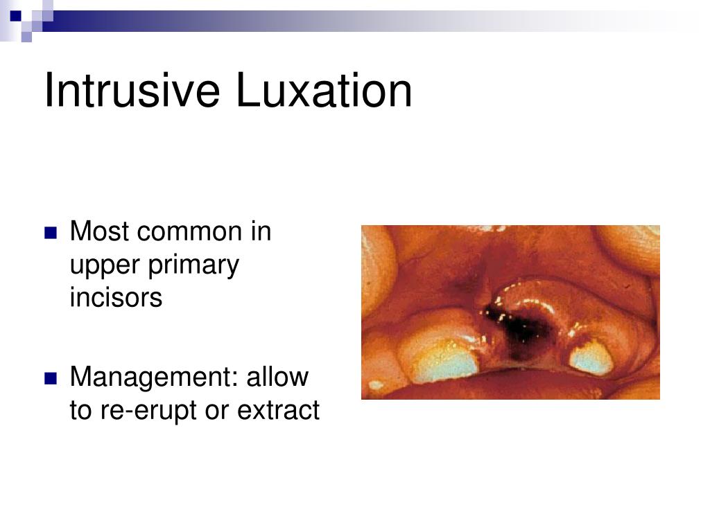 PPT - Follow up in 4 weeks: Advise parents of possible injury / damage ...