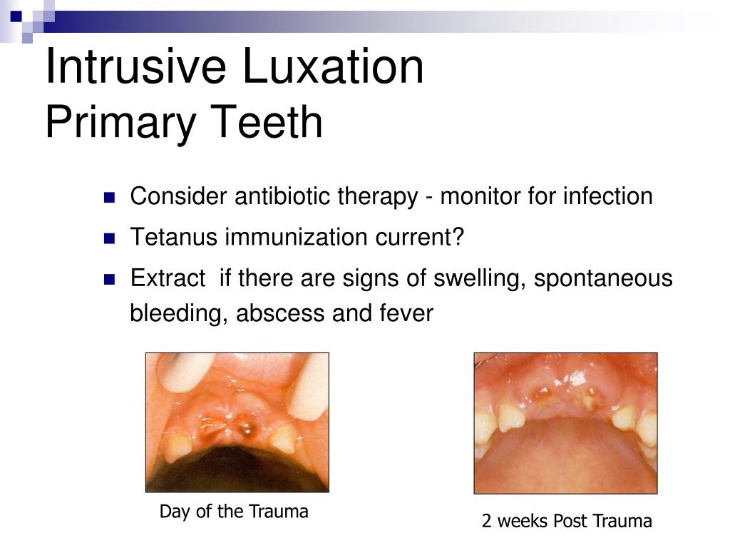 PPT - Follow up in 4 weeks: Advise parents of possible injury / damage ...