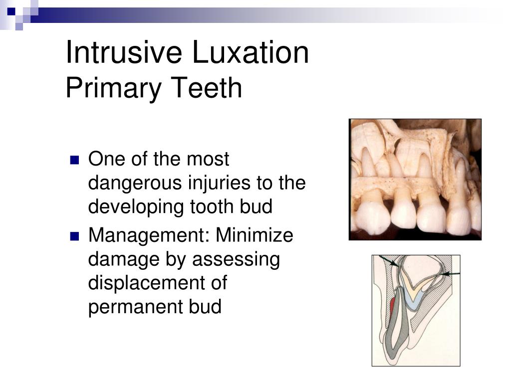PPT - Follow up in 4 weeks: Advise parents of possible injury / damage ...