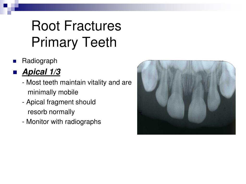 PPT - Follow up in 4 weeks: Advise parents of possible injury / damage ...