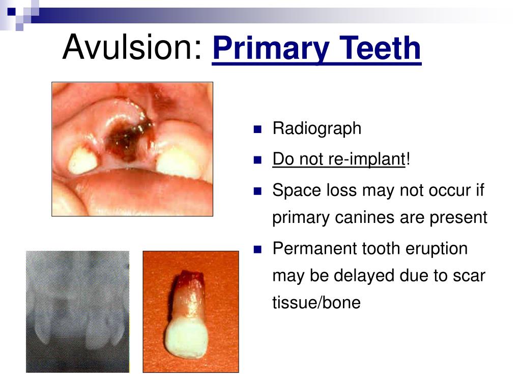 PPT - Follow up in 4 weeks: Advise parents of possible injury / damage ...