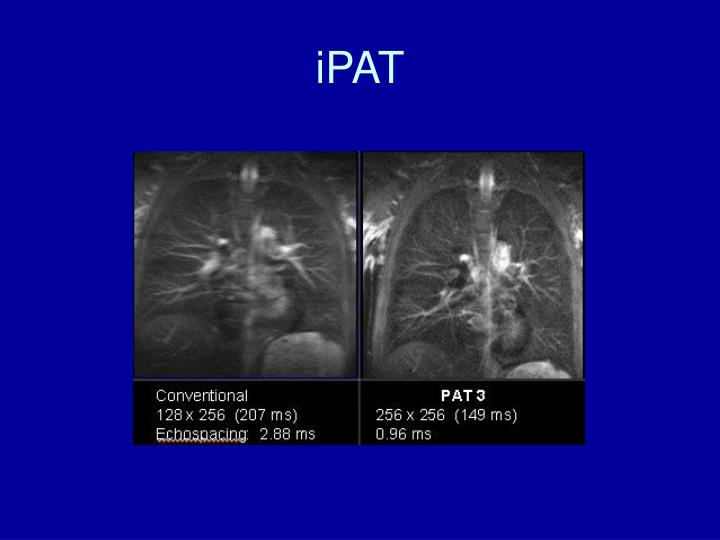 PPT - Parallel Imaging – making SENSE of GRAPPA PowerPoint Presentation ...