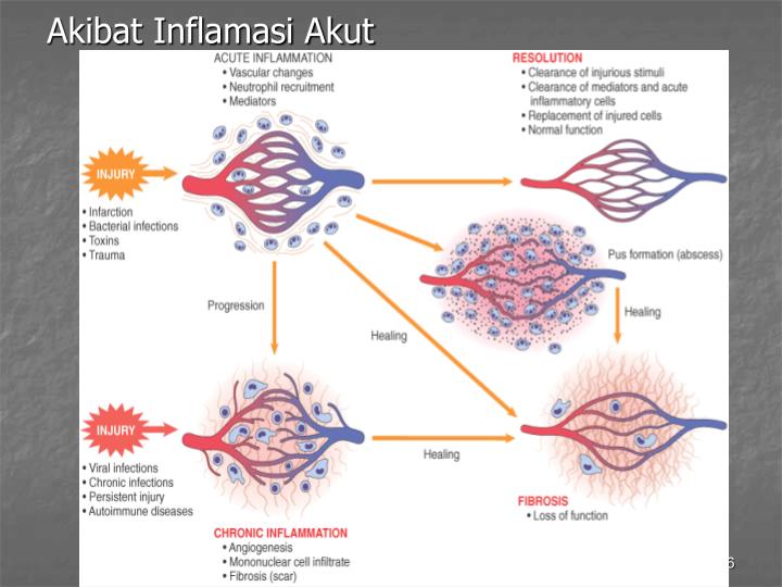 PPT - RESPON INFLAMASI (KP. 2.1.27) PowerPoint Presentation - ID:4580455