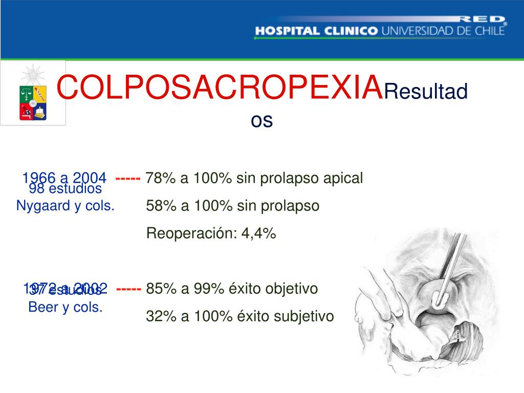 PPT - COLPOSACROPEXIA: ¿abordaje abdominal, laparoscópico o robótico ...