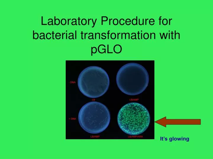 PPT - Laboratory Procedure for bacterial transformation with pGLO ...