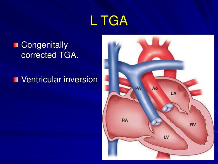 PPT - Congenital Heart Diseases II PowerPoint Presentation - ID:4589614