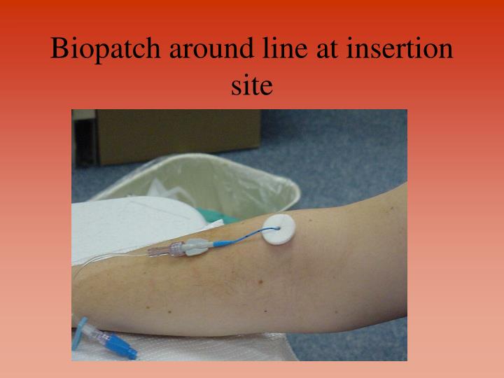 PPT - PICC and Midline Catheters PowerPoint Presentation - ID:4591964