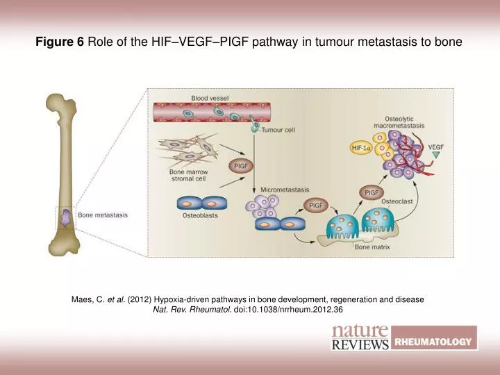 PPT - Figure 6 Role of the HIF–VEGF–PIGF pathway in tumour metastasis ...