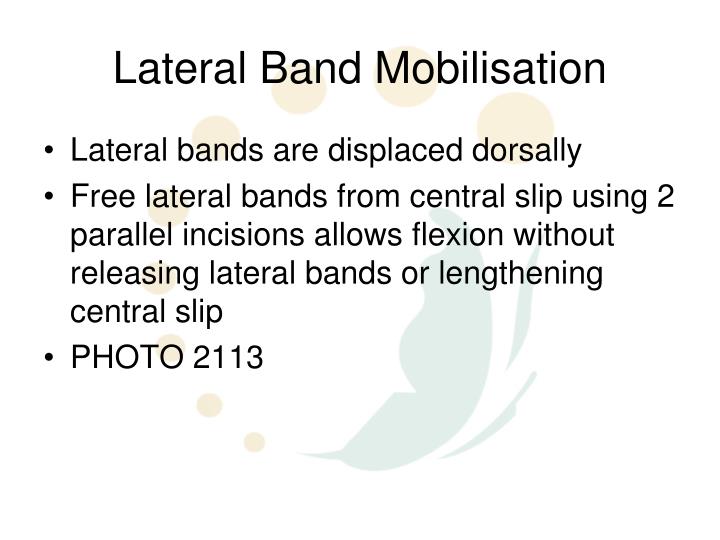 PPT - Swan Neck Deformity PowerPoint Presentation - ID:4595264