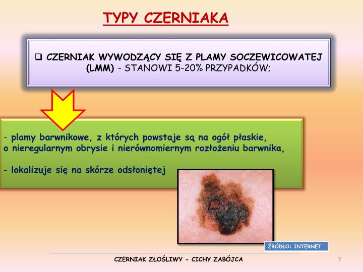 PPT - CZERNIAK PowerPoint Presentation - ID:4598287