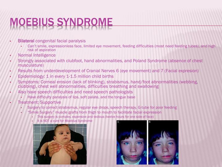PPT - Facial Palsy PowerPoint Presentation - ID:4602806