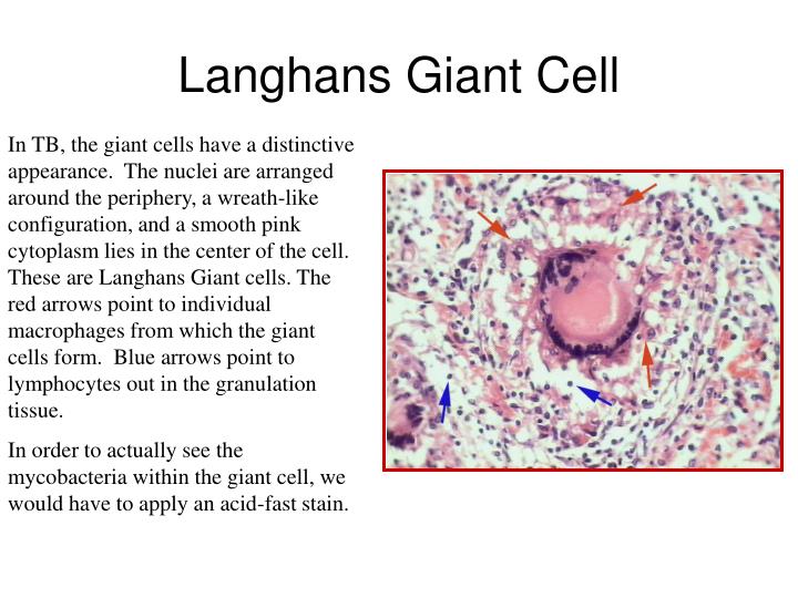 PPT - Periapical Granuloma PowerPoint Presentation - ID:4604077